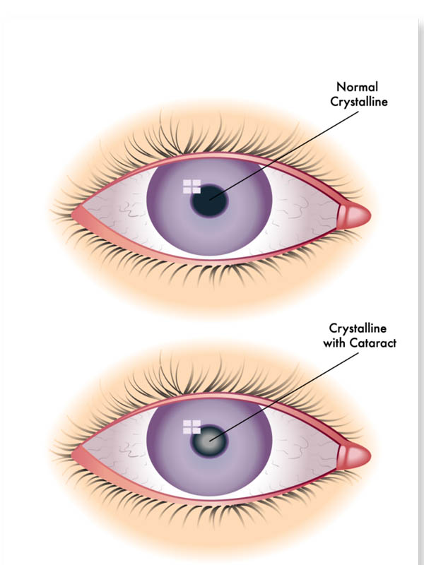 Ratnam Superspeciality Eye Hospital: Rajajipuram, Lucknow